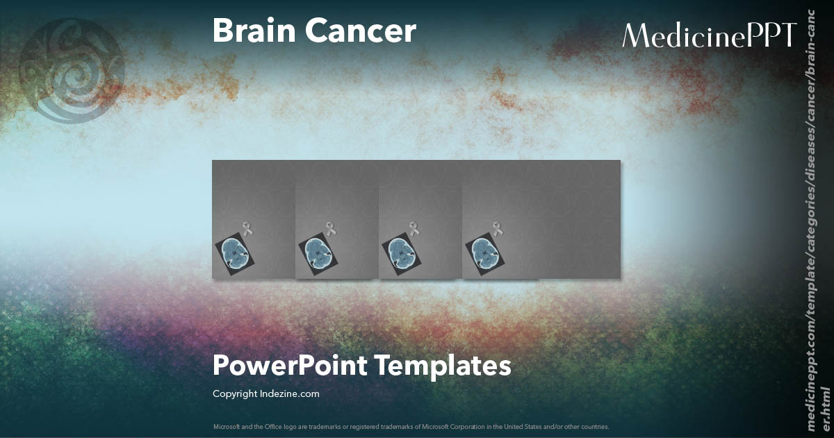 Brain Cancer - Medicine PowerPoint Templates