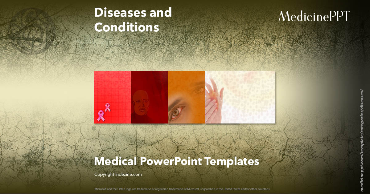 Medicine PowerPoint: Diseases and Conditions Medicine PowerPoint Templates