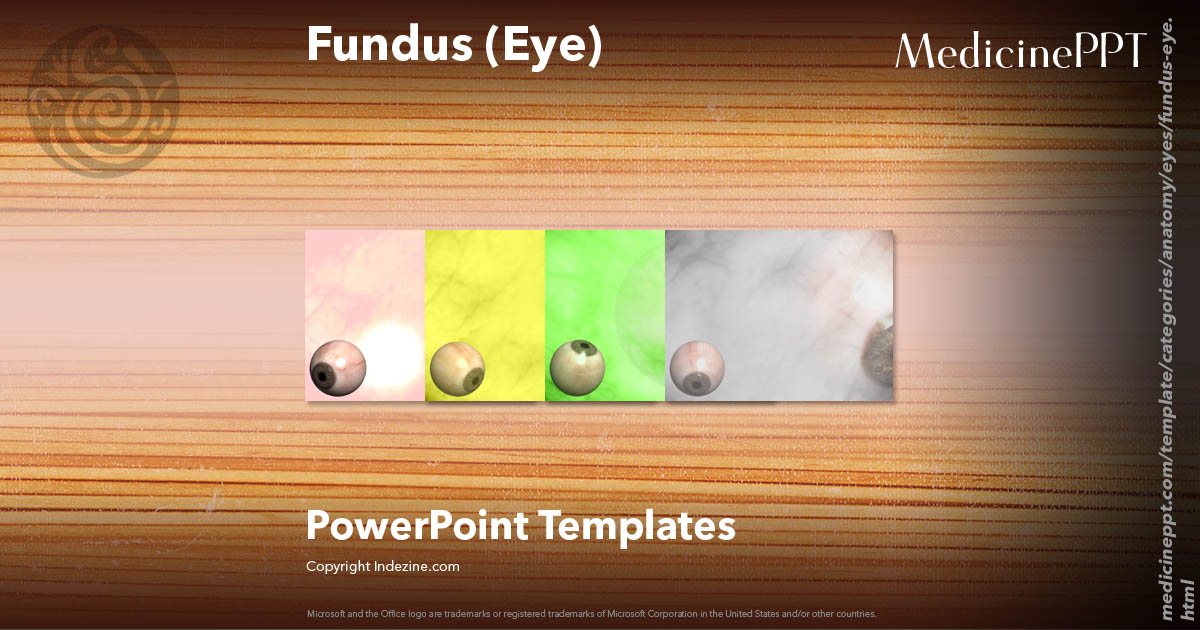 Fundus (Eye) - Medicine PowerPoint Templates