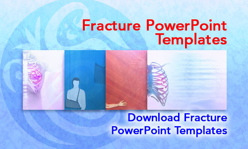 Fracture Medicine PowerPoint Templates