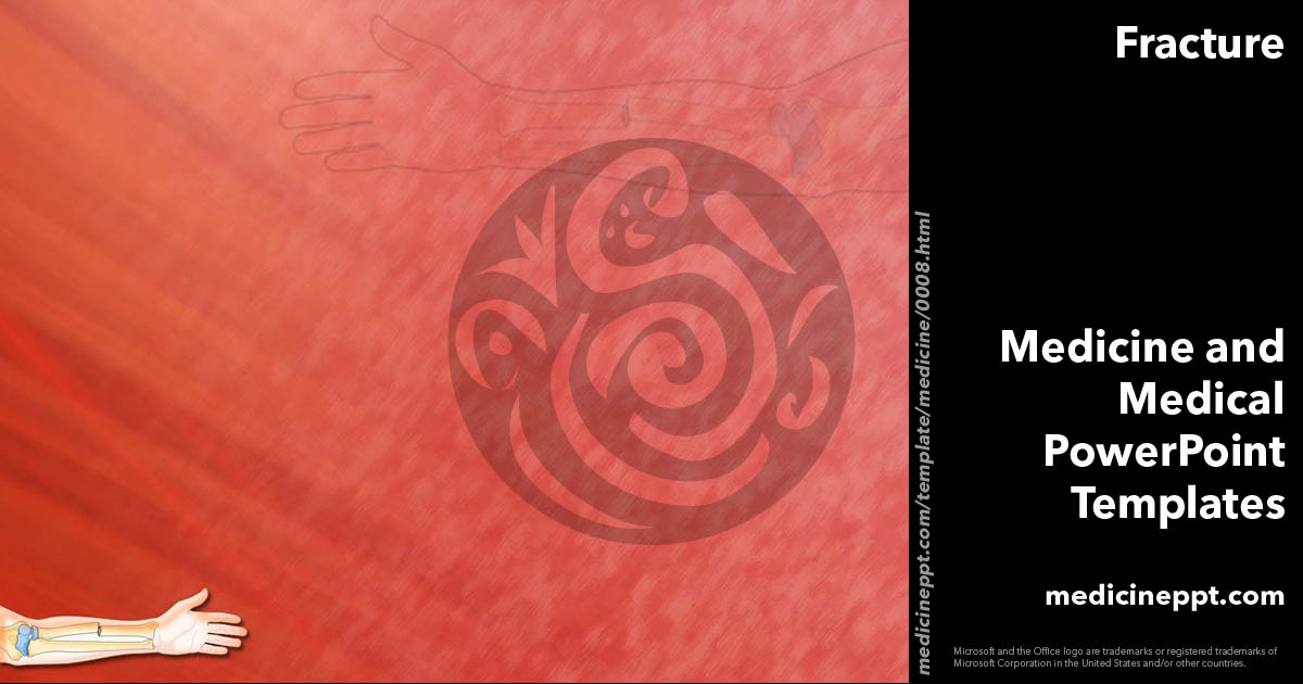 Fracture 01 - Medicine PowerPoint Templates