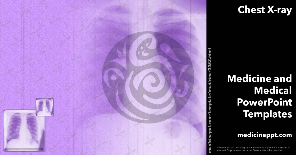 Chest X-ray 02 - Medicine PowerPoint Templates