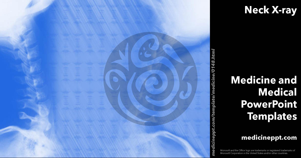 Neck X-ray 02 - Medicine PowerPoint Templates