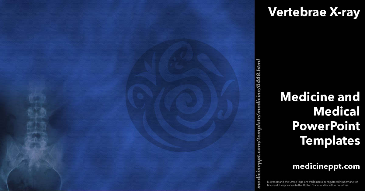 Vertebrae X-ray 02 - Medicine PowerPoint Templates